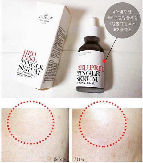 Cách sử dụng Red Peel từ A-Z và Chăm sóc da sau peel - Review Đẹp